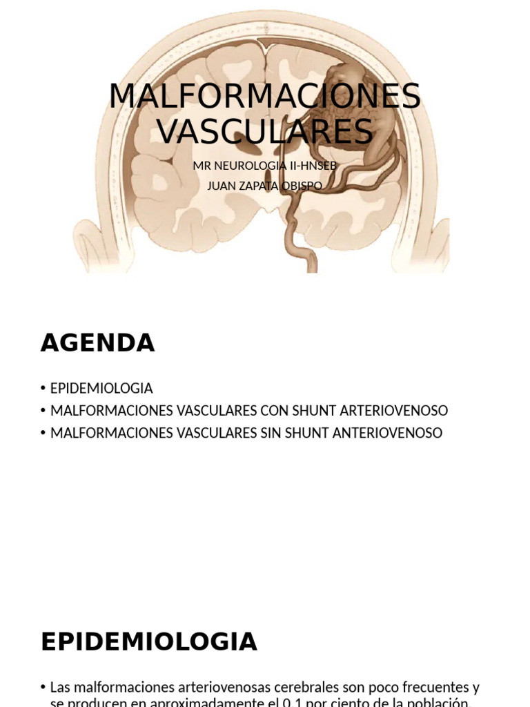 Exposocion Mav | PDF | Desórdenes neurológicos | Enfermedades y trastornos