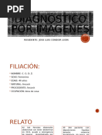 Clase Ileo Obstructivo y No Obstructivo | PDF | Intestino grueso | Abdomen