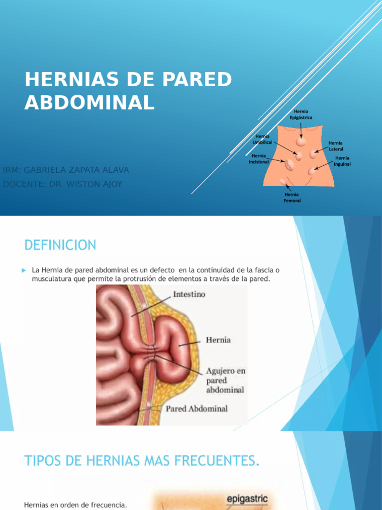 Hernias de Pared Abdominal Gaby Zapata | PDF | Wellness