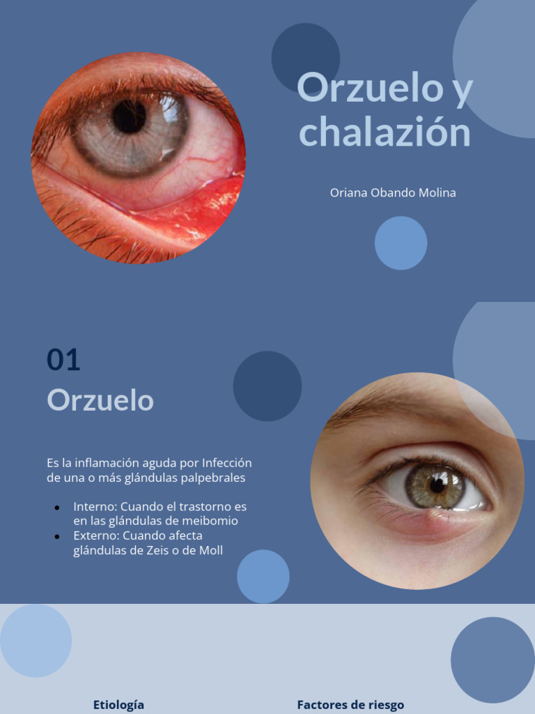 Orzuelo y Chalazion | PDF | Inmunología | Epidemiología