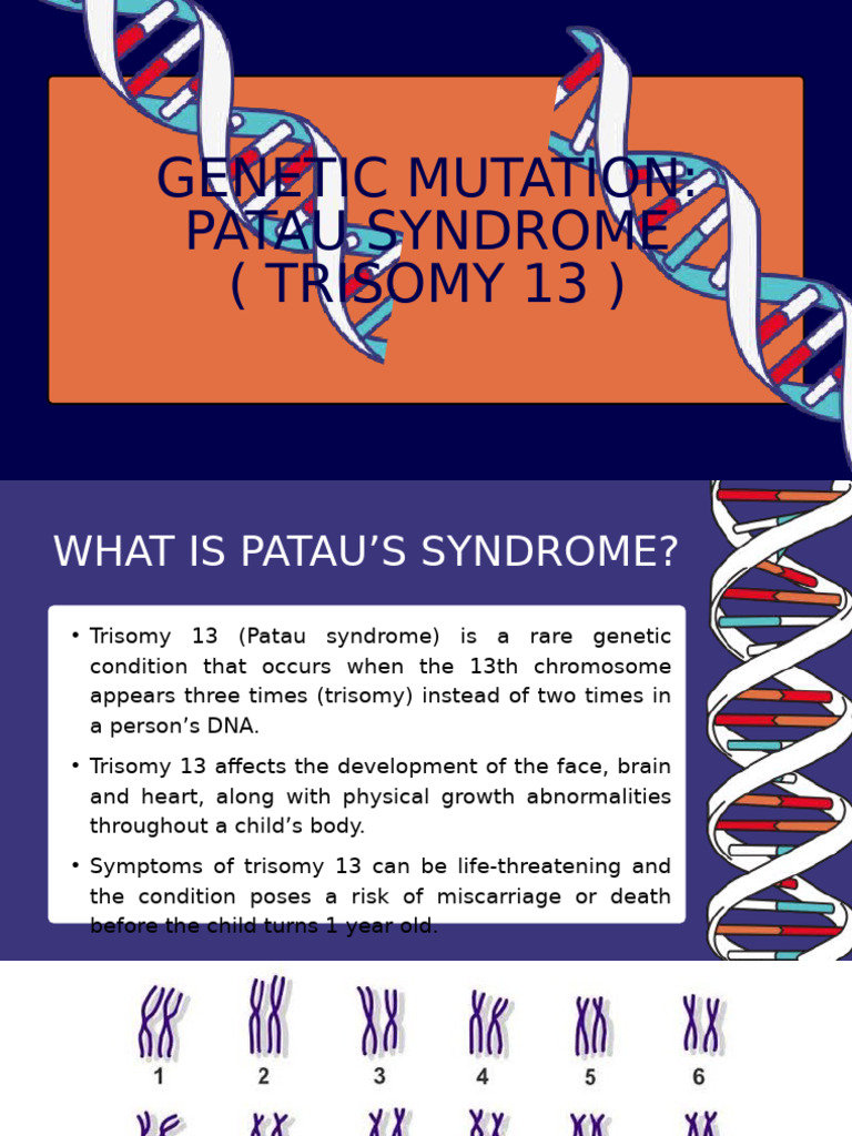 Group 2 - Patau Syndrome | PDF | Diseases And Disorders | Human ...