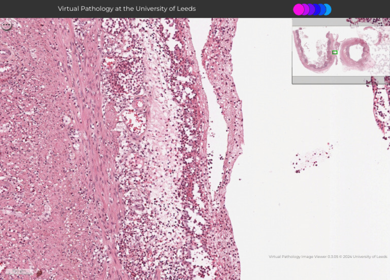 Slide Viewer Virtual Pathology at The University of Leeds 2 | PDF