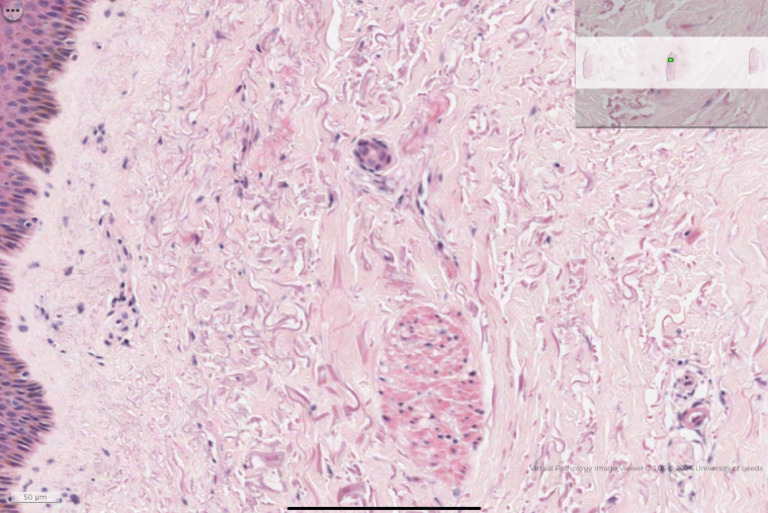 Slide Viewer Virtual Pathology at The University of Leeds 4 | PDF