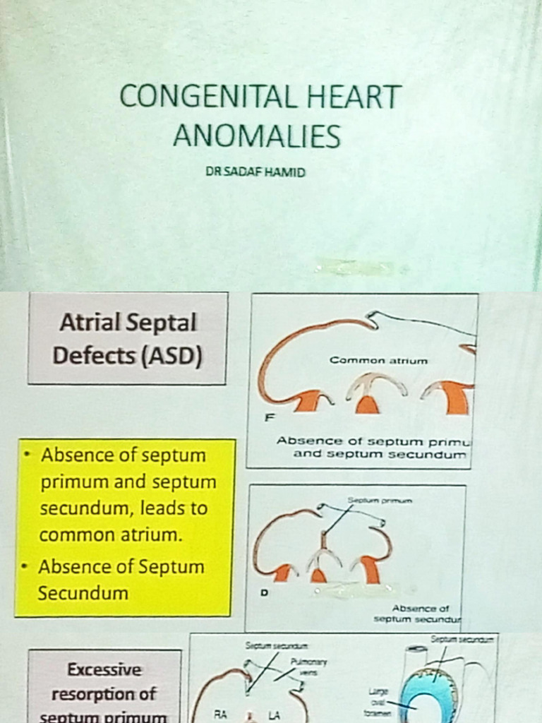 Lec2 Congenital Heart Anomalies | PDF