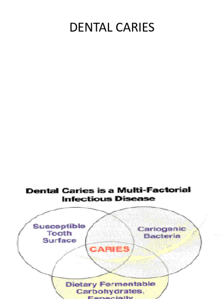 Dental Caries Presentation | PDF | Laser | Human Tooth