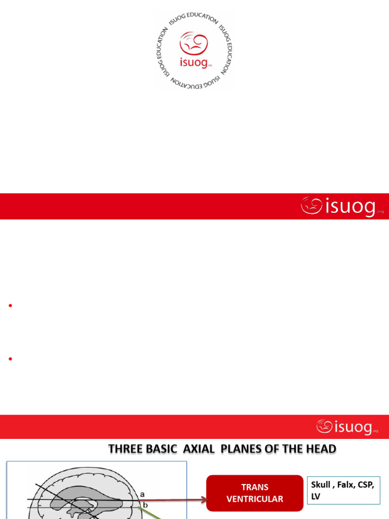 fetal cns isuog | PDF | Brain