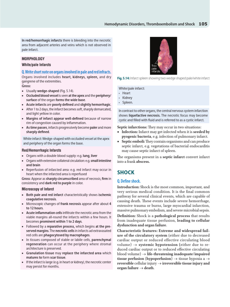 Septic Shock Ram Das Nayak | PDF | Shock (Circulatory) | Sepsis