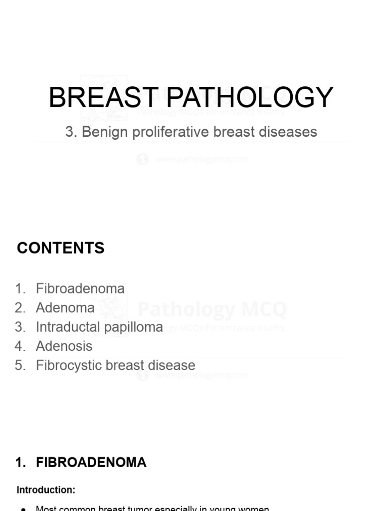 Breast Pathology for Specialists | PDF | Epithelium | Adenoma