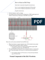 EKG Flash Cards | PDF | Cardiac Arrhythmia | Cardiovascular System