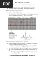 Basic EKG ECG Rhythms Cheatsheet | PDF | Electrocardiography | Cardiac ...