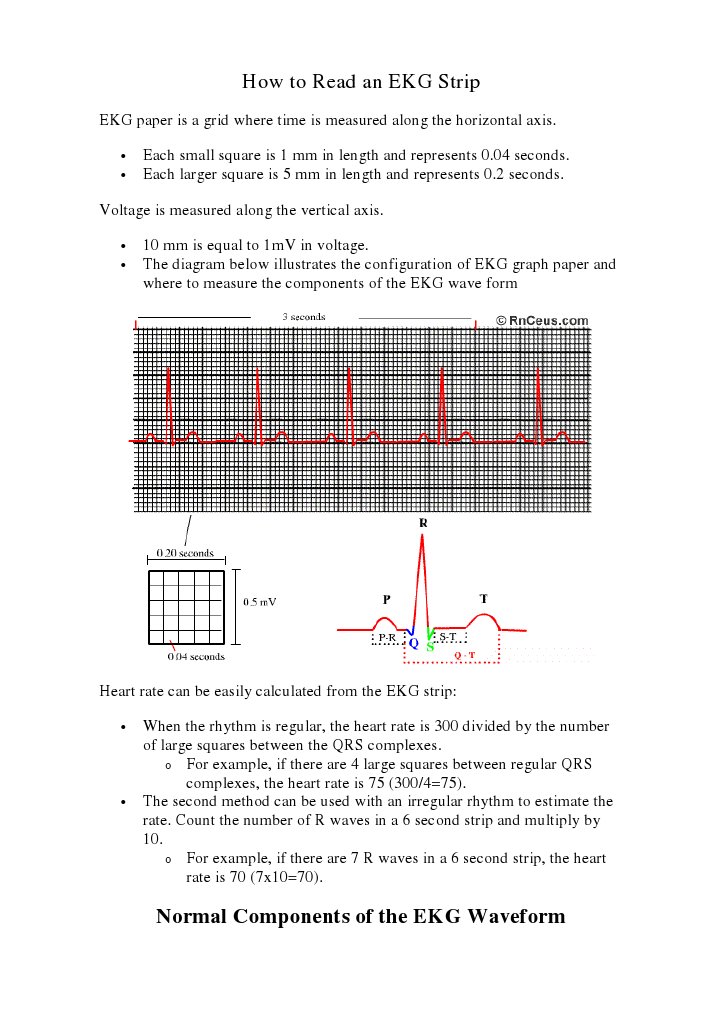 EKG Strip Reading and Measurement Guide | PDF | Electrocardiography ...