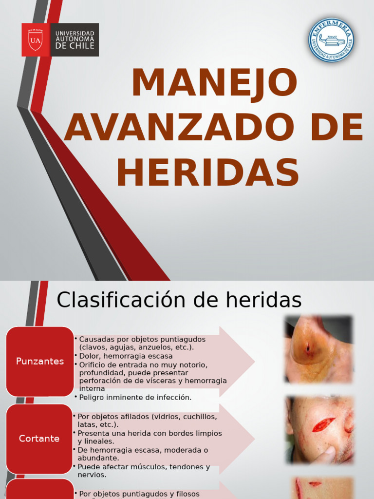 Curacion Avanzada de Heridas | PDF | Herida | Especialidades Medicas