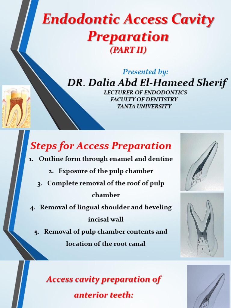 Access Cavity DR Dalia (2) 2022-2023 | PDF | Tooth Enamel | Medical ...