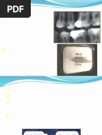 11 - Occlusal Radiography - Pocket Dentistry | PDF | Radiography ...