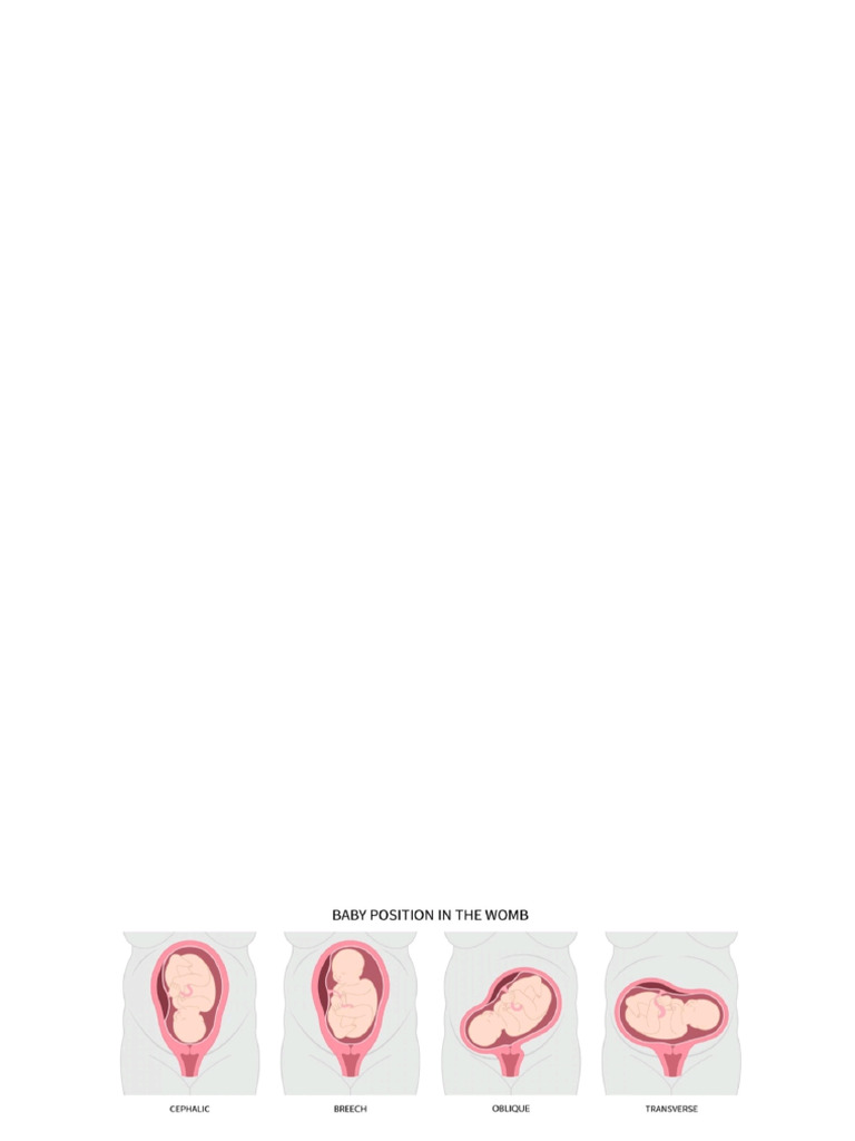 Baby Postion | PDF
