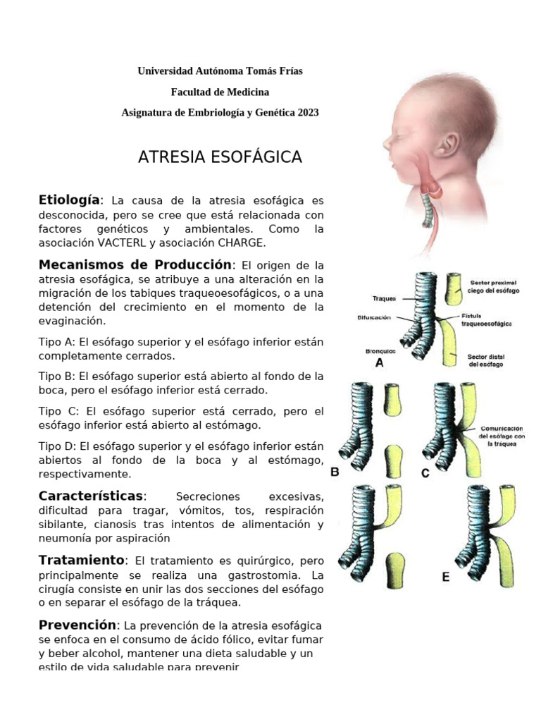 Atresia Esofágica: Causas y Tratamiento | PDF