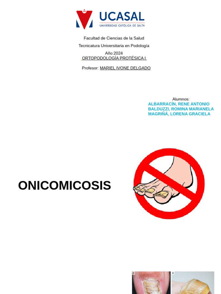 ONICOMICOSIS | PDF | Medicina CLINICA | Especialidades Medicas