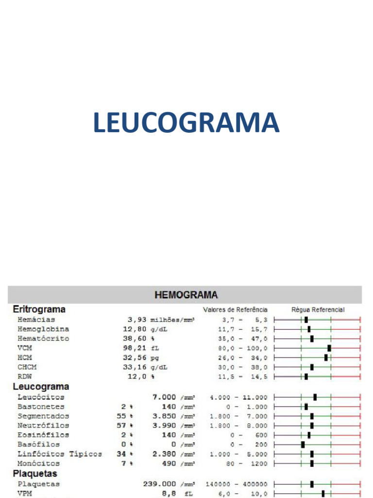 Aula 10_Leucograma | PDF | Linfócito | Sangue
