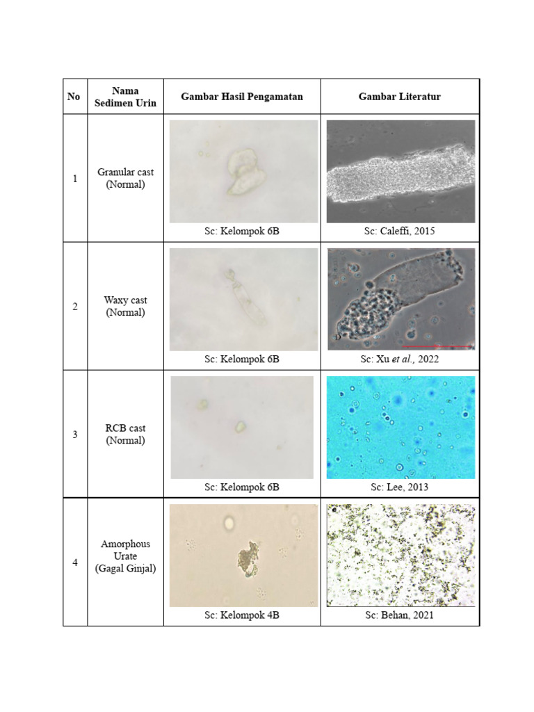 Gambar Sedimen Urin 6b Fix | PDF | Urinary System | Medical Specialties
