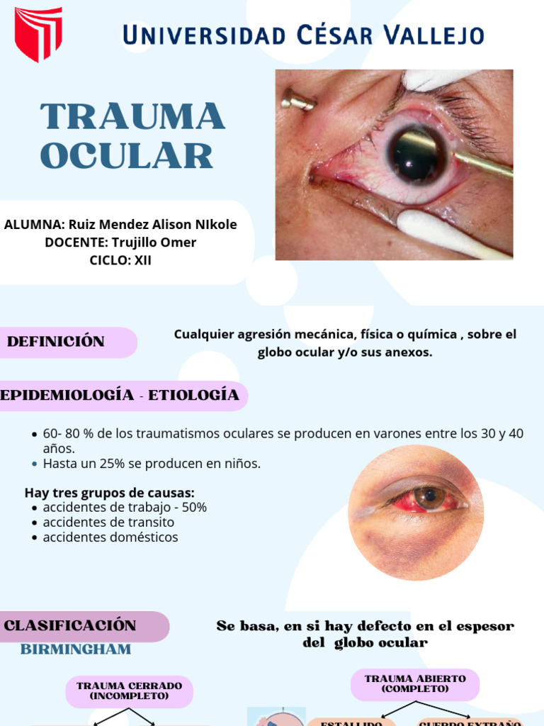 Trauma Ocular | PDF | Causas de la muerte | Medicina CLINICA