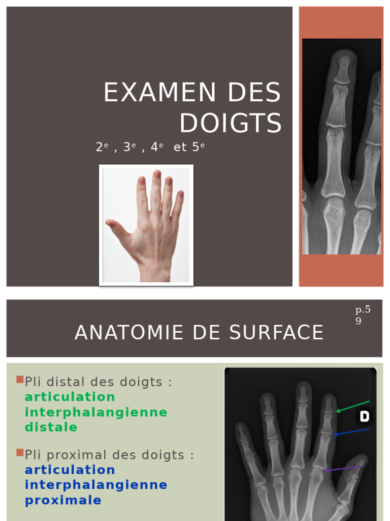 Anatomie des Articulations des Doigts | PDF | Articulation (anatomie ...