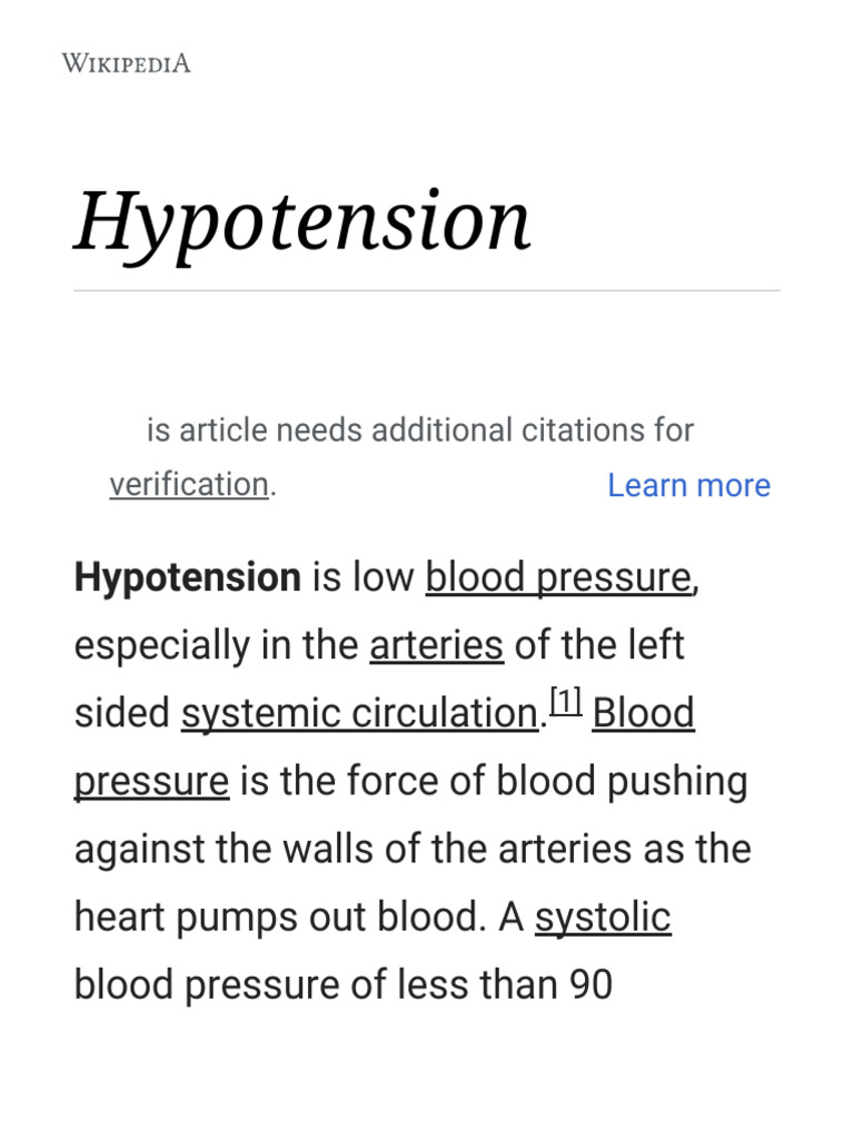 Hypotension - information | PDF | Blood Pressure | Clinical Medicine