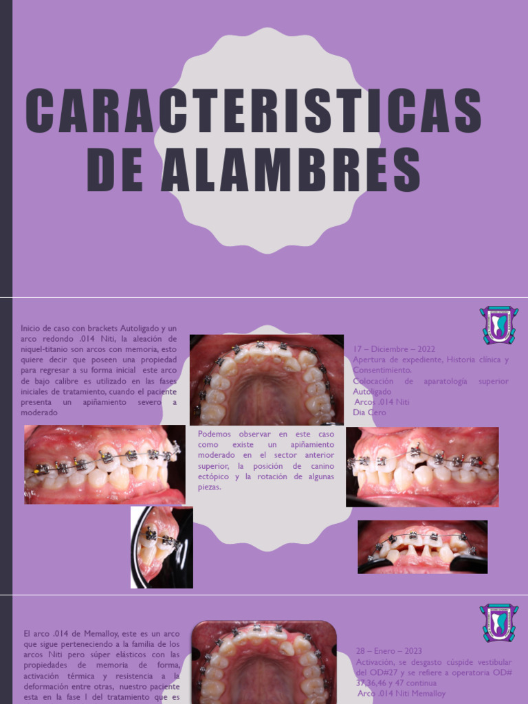 Caracteristicas de Alambres | PDF
