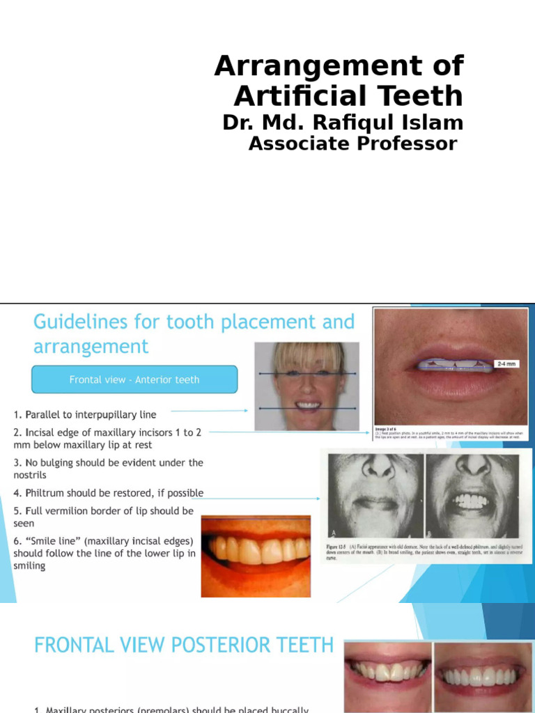 Arrangement of Teeth | PDF | Dentistry | Dentistry Branches