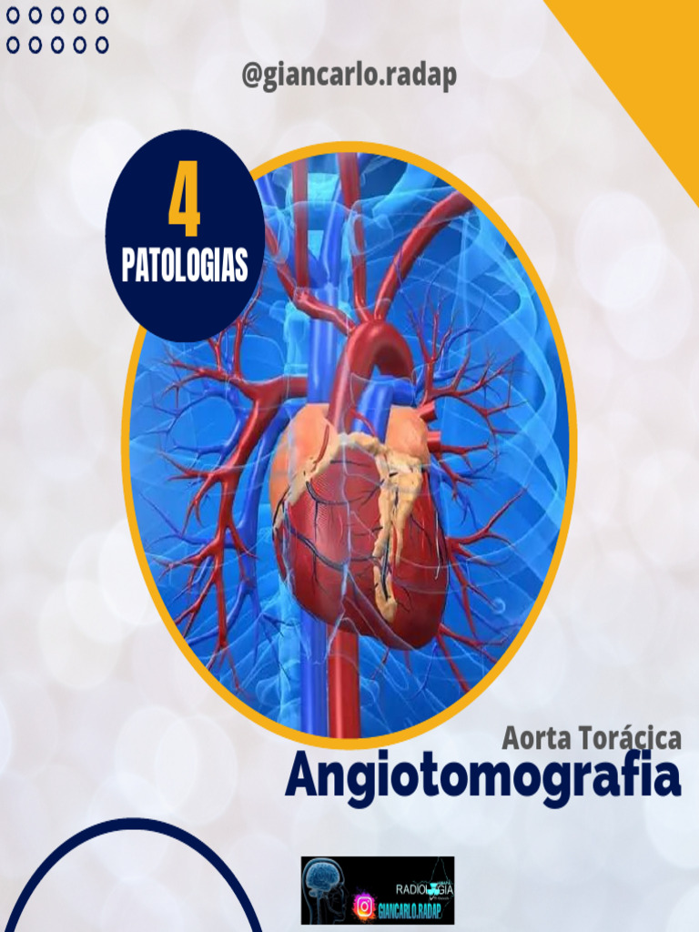 Patologias Angio TC Tórax. | PDF | Coração | Artéria