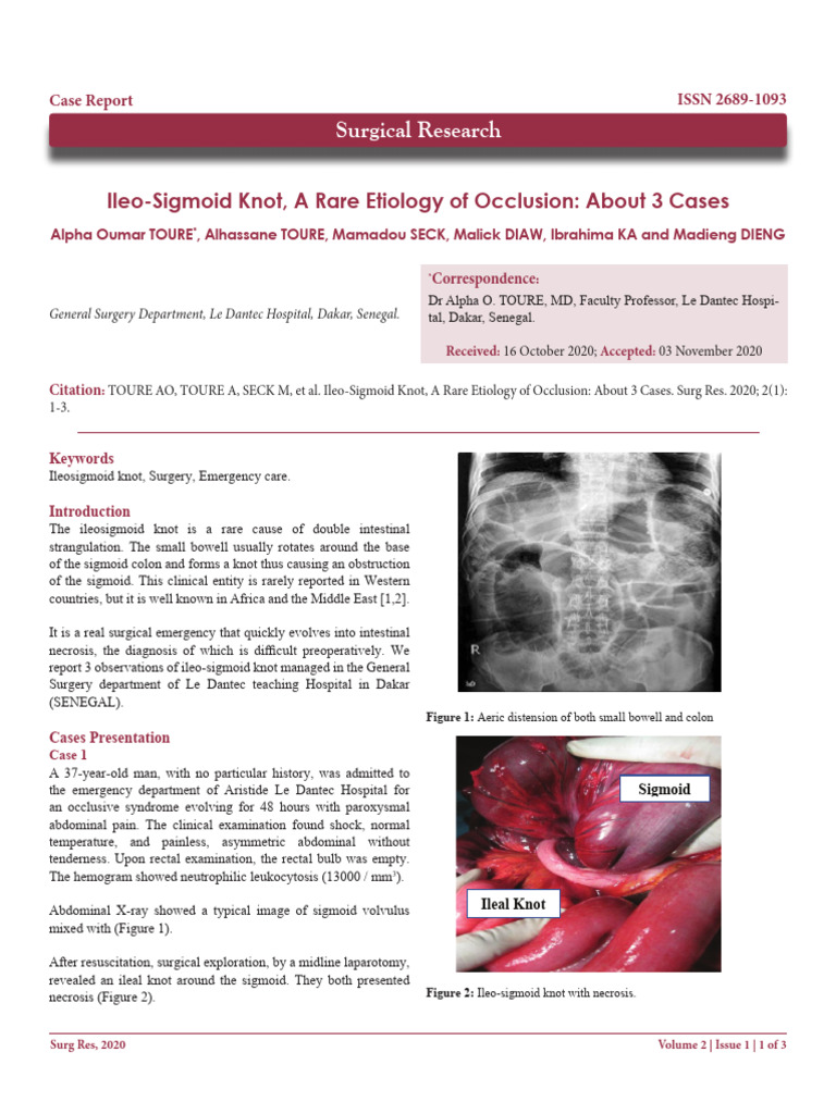 Ileo-Sigmoid Knot, A Rare Etiology of Occlusion: About 3 Cases | PDF ...