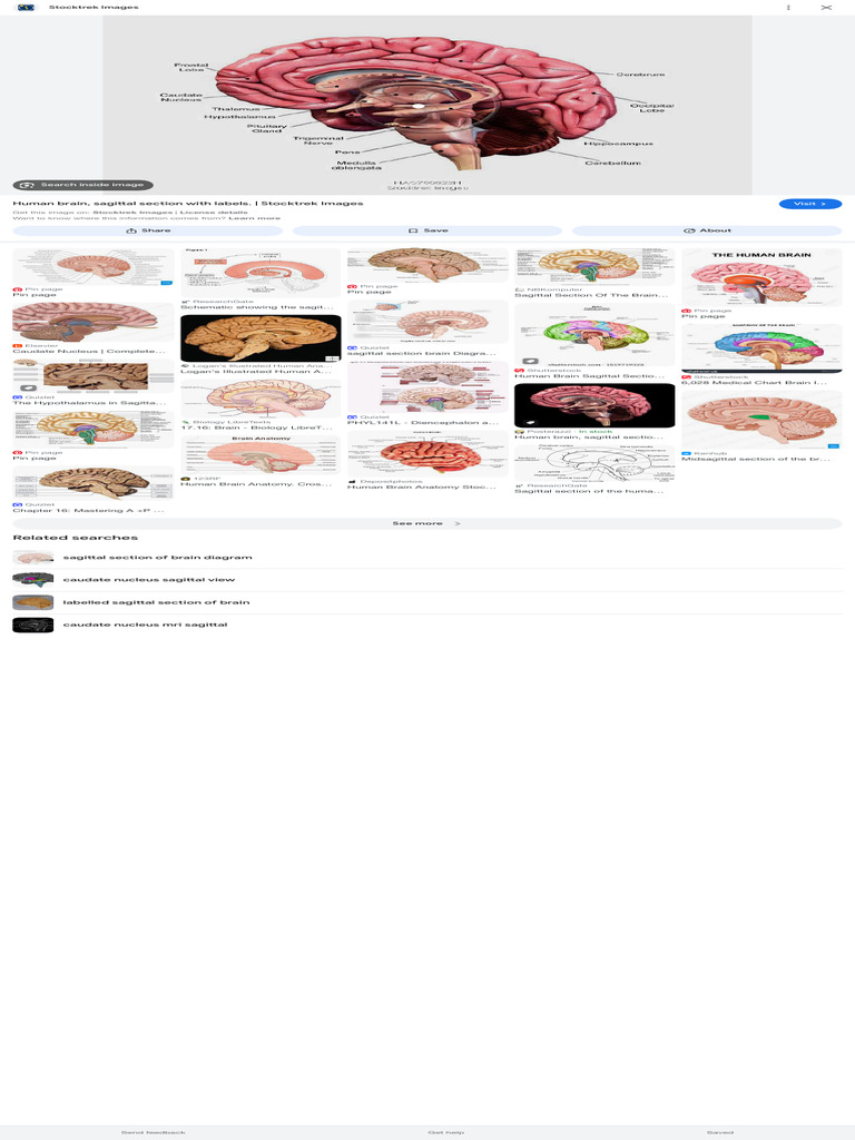 Searchq Caudate+nucleus+in+sagittal+section+of+brain&sca Esv Dcbcba9590325d4b&sca Upv 1&rlz ...