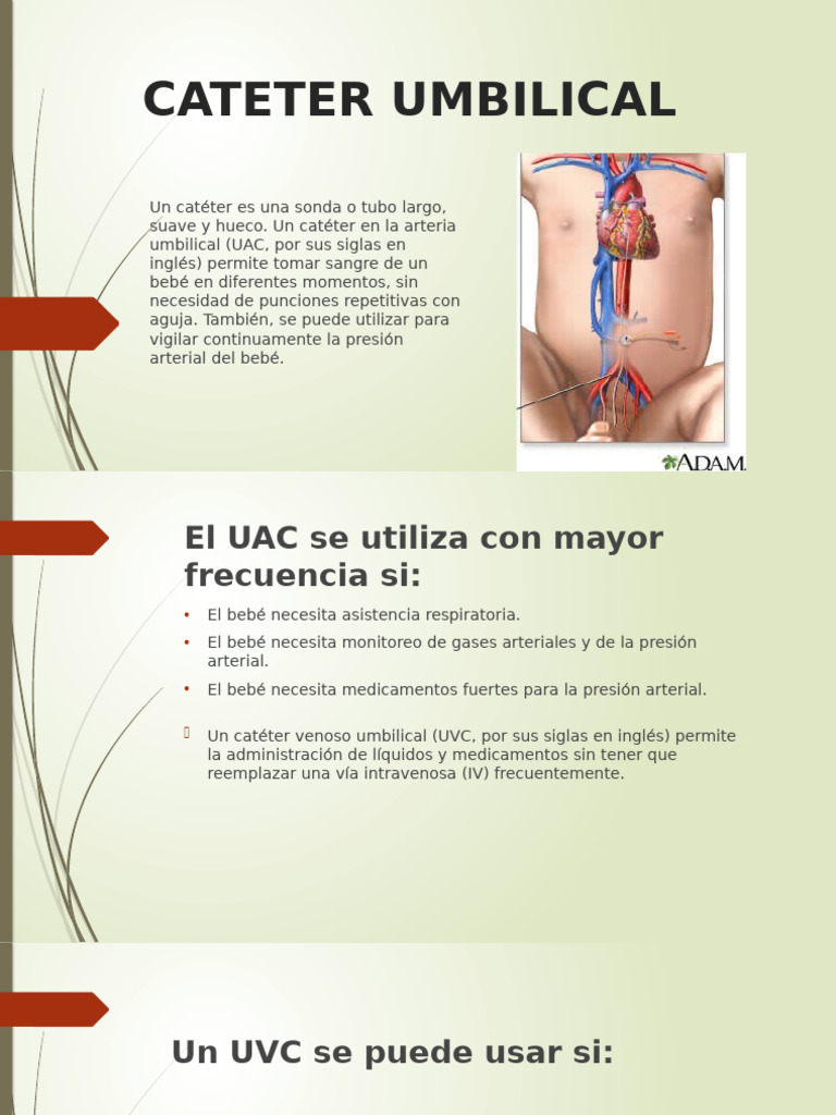Cateter Umbilical | PDF