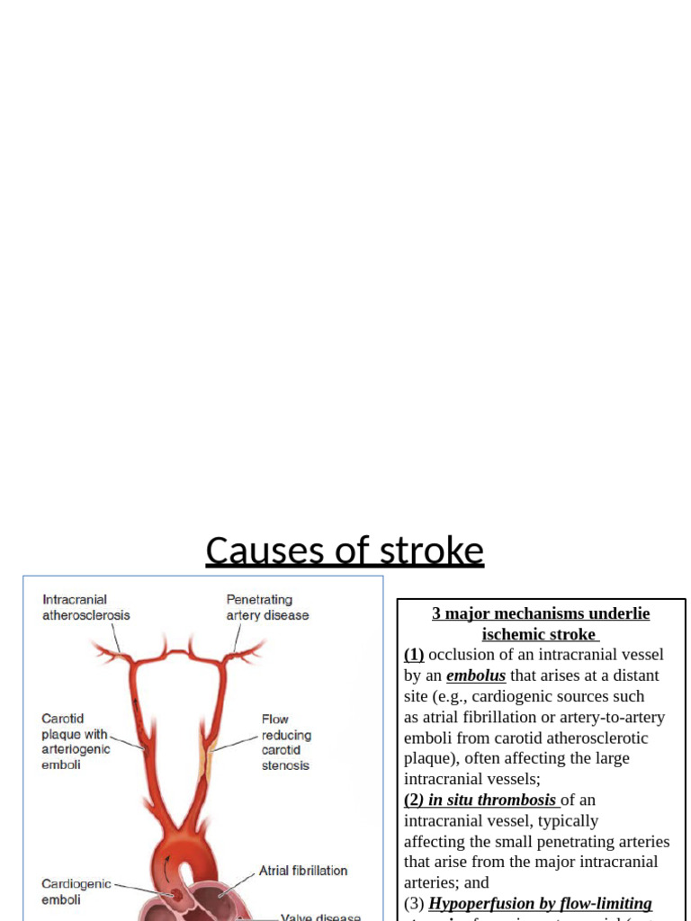 Stroke | PDF | Stroke | Thrombosis