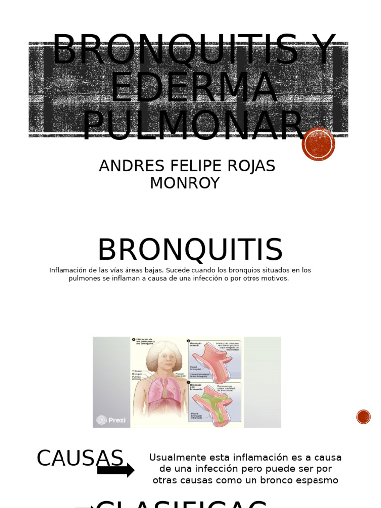 BRONQUITIS Y EDERMA PULMONAR | PDF | Bronquitis | Tos
