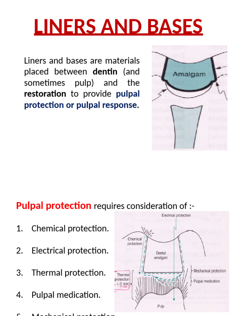 Pulp Protection Summary | PDF | Dentin | Varnish