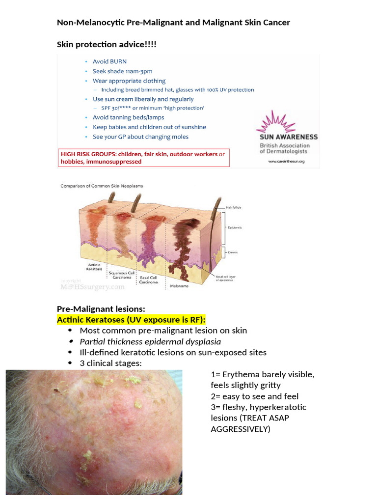 NonMelanocytic PM and M Skin Cancer | PDF