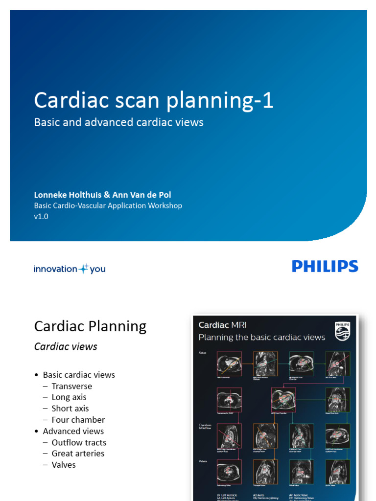 Cardiac Scan Planning | PDF | Heart Valve | Ventricle (Heart)