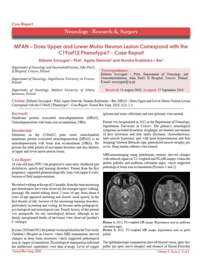 MPAN - Does Upper and Lower Motor Neuron Lesion Correspond With The ...