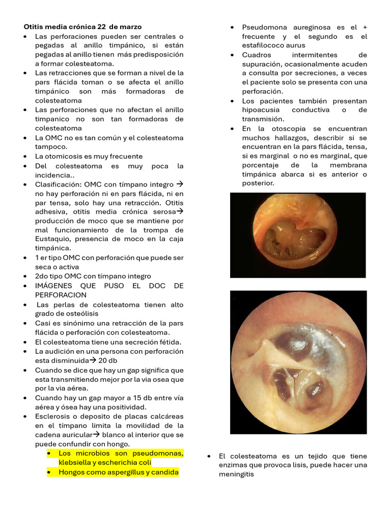 Otitis Media Crónica 22 de Marzo | PDF | Sistema nervioso ...
