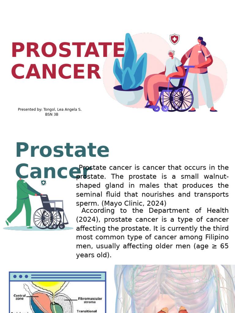 Geria - Report (Prostate Cancer) | PDF | Prostate | Prostate Specific Antigen