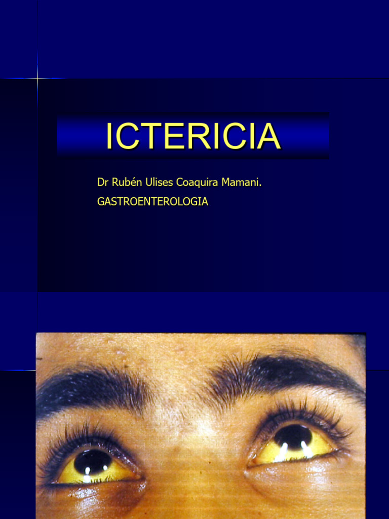 Definición y Clasificación de Ictericia | PDF | Especialidades Medicas ...