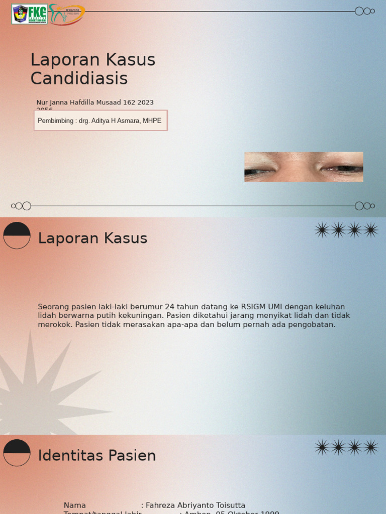 Candidiasis Dilla | PDF | Planets | Planets In Astrology