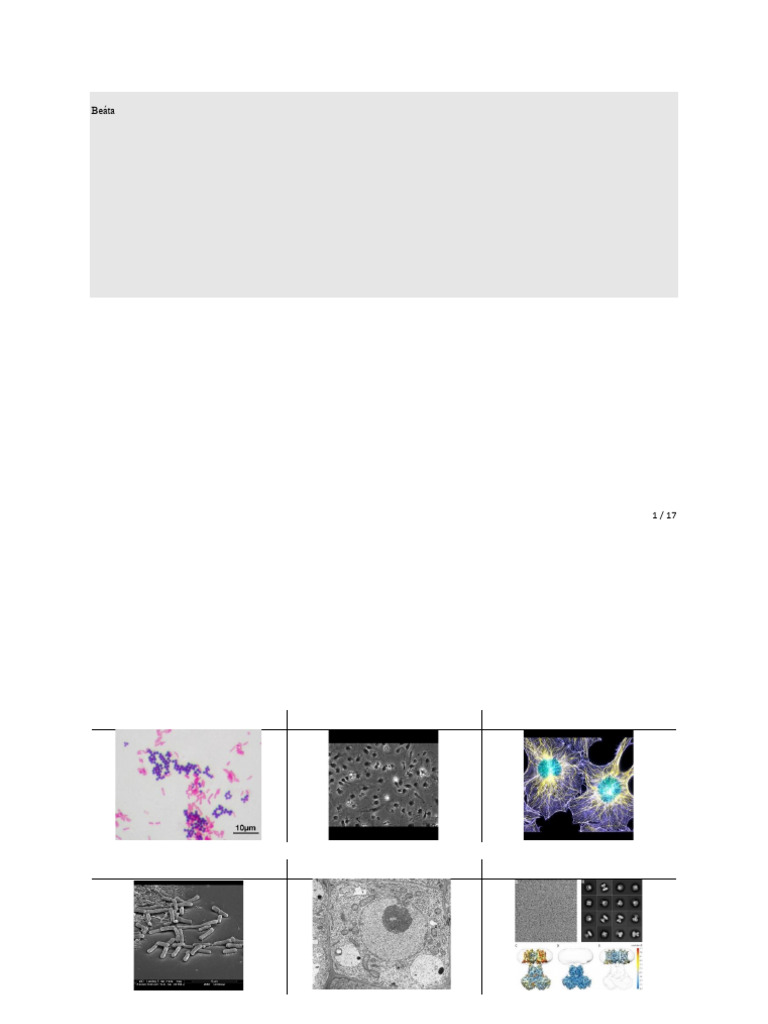Electron Micros | PDF | Microscope | Angular Resolution