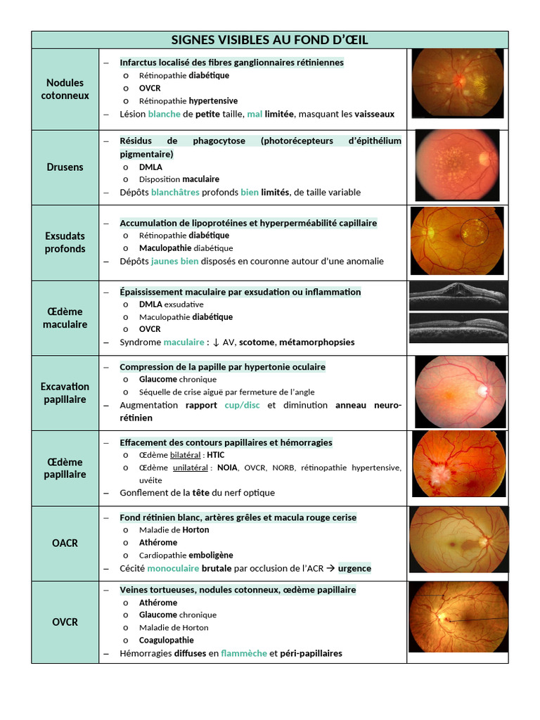 Signes au Fond d'Œil et Cécité Monoculaire | PDF | Glaucome | Ophtalmologie