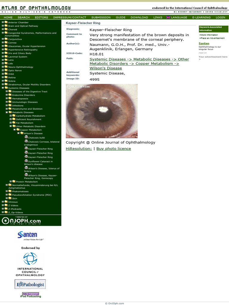 Atlas of Ophthalmology | PDF | Cornea | Human Eye