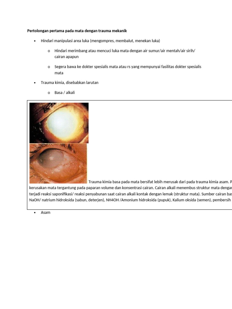Pertolongan Pertama Pada Mata Dengan Trauma Mekanik | PDF