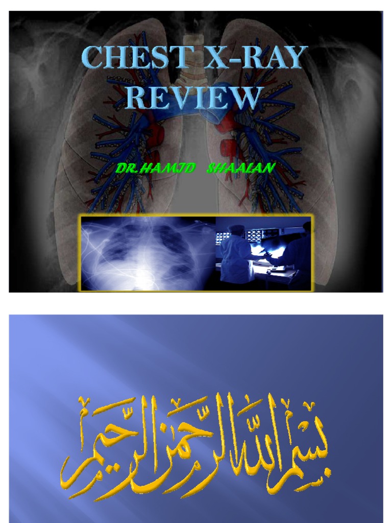 Hilar Fullness in Chest X-Ray Analysis | PDF | Lung | Heart