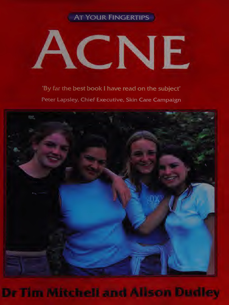Acne - The - at Your Fingertips - Guide - Mitchell, Tim (Timothy John ...