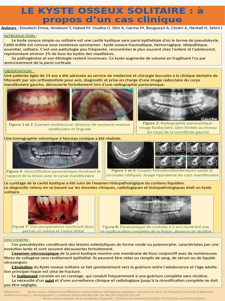 Kyste osseux solitaire mandibulaire : cas clinique | PDF | Radiographie ...