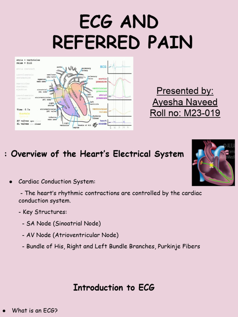 Ecg and Referred Pain | PDF